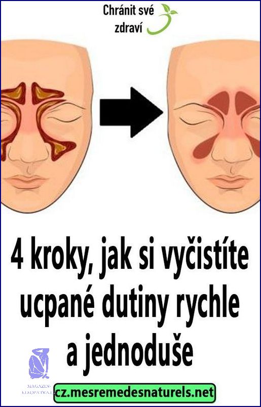Jak Uvolnit Ucpané Dutiny Květen 2026 - Magazin-Kleopatra.cz