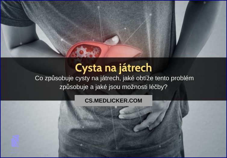 Co Pomáhá Na Cysty V Prsu? Tady Je Odpověď! Leden 2026 - Magazin ...